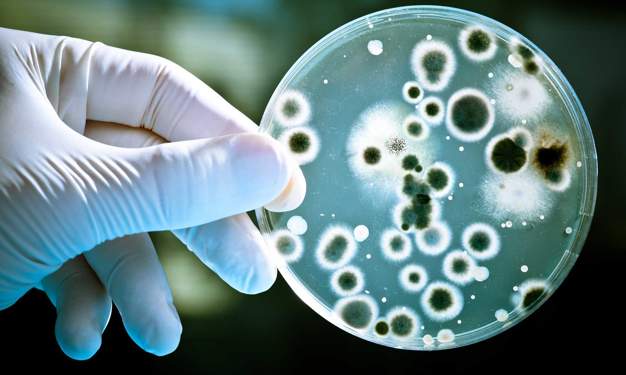 ISO-norm voor kweekmedia wordt herzien | Agro&Chemie